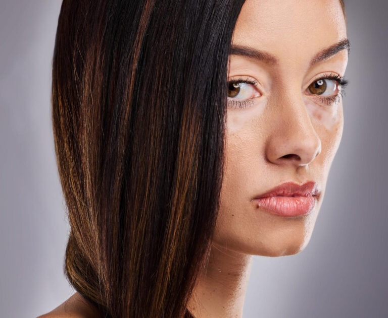 Understanding the Causes and Cures of Skin Discoloration