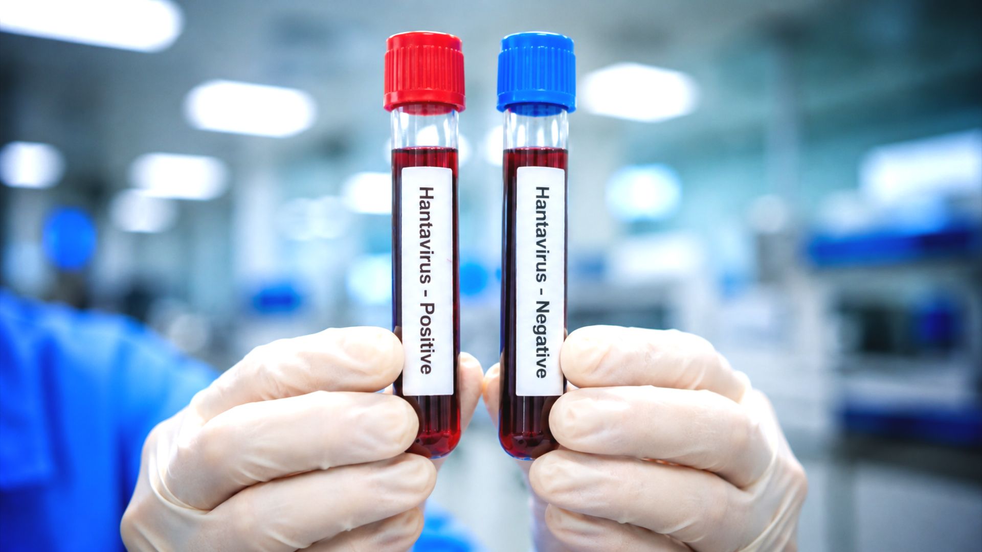 Two Singapore residents exposed to hantavirus, potentially fatal, with ...
